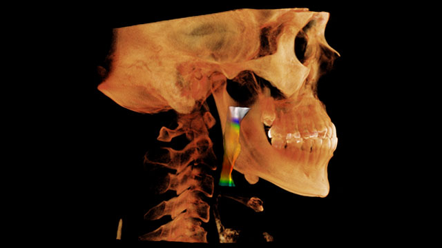 Capture 3D Radiology – Online radiology interpretations by Oral ...