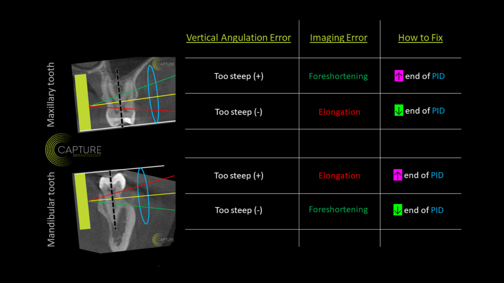 Intraoral Radiographs | Capture 3D Radiology